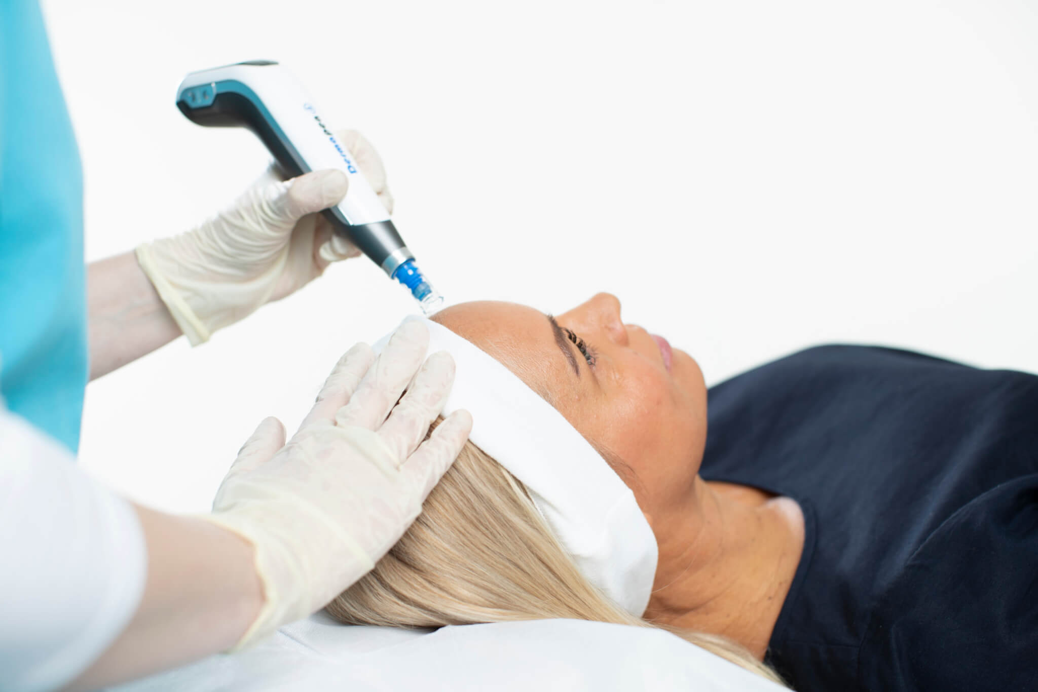 Micro-Needling - The Cosmetic Clinic