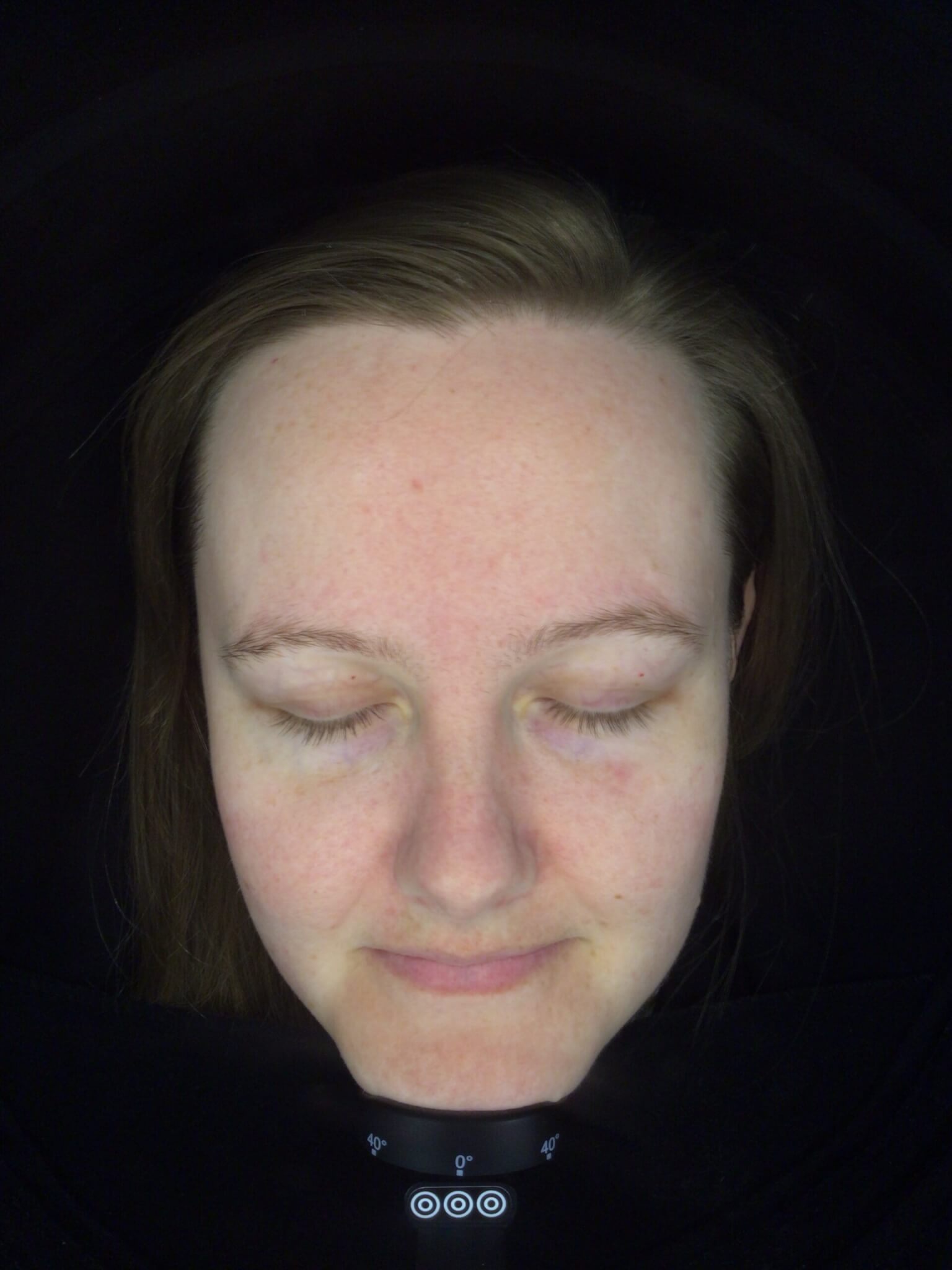 Observ 520: Your Complimentary Skin Analysis - The Cosmetic Clinic