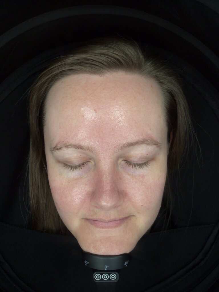 Observ 520: Your Complimentary Skin Analysis - The Cosmetic Clinic