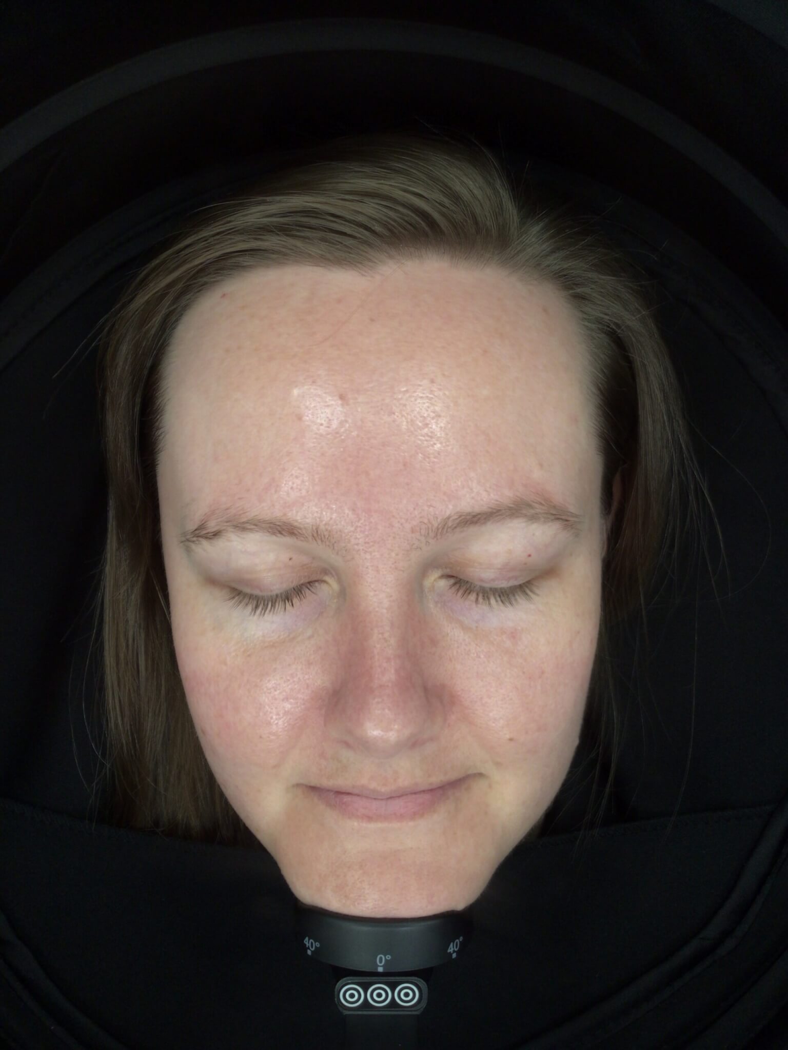 Observ 520: Your Complimentary Skin Analysis - The Cosmetic Clinic